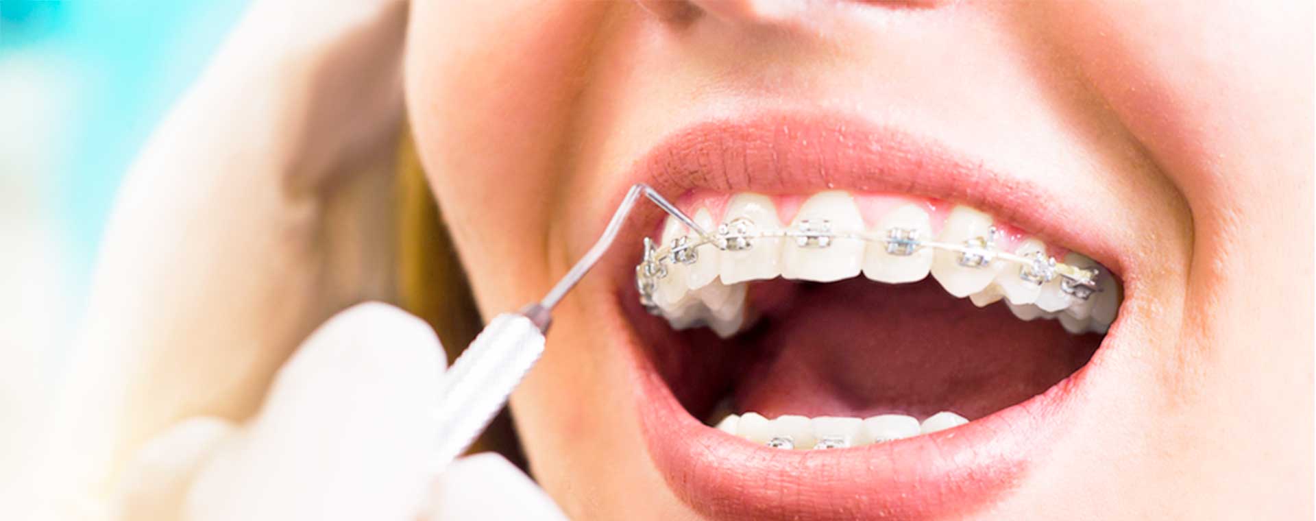 Transforma tu Sonrisa con un Tratamiento de Ortodoncia: La Llave hacia ...